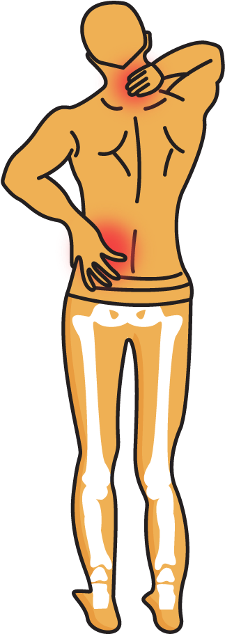 Download Fallen Arch And Back Pain - ClipartKey