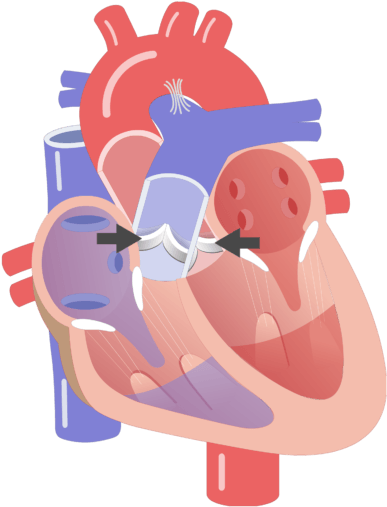 Download Semilunar Valves Closing Animation Slide - Animated Pic Of The ...
