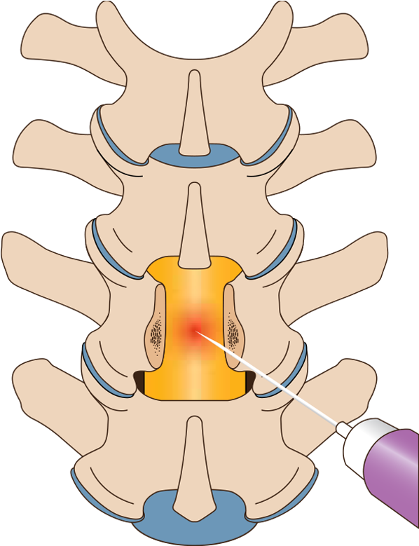 Download Cartoon - ClipartKey