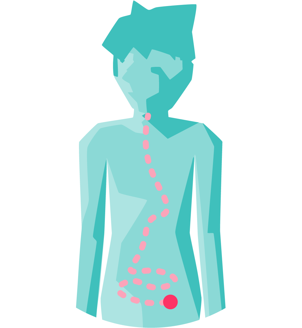 Download Inflammatory Bowel Disease - Illustration - ClipartKey