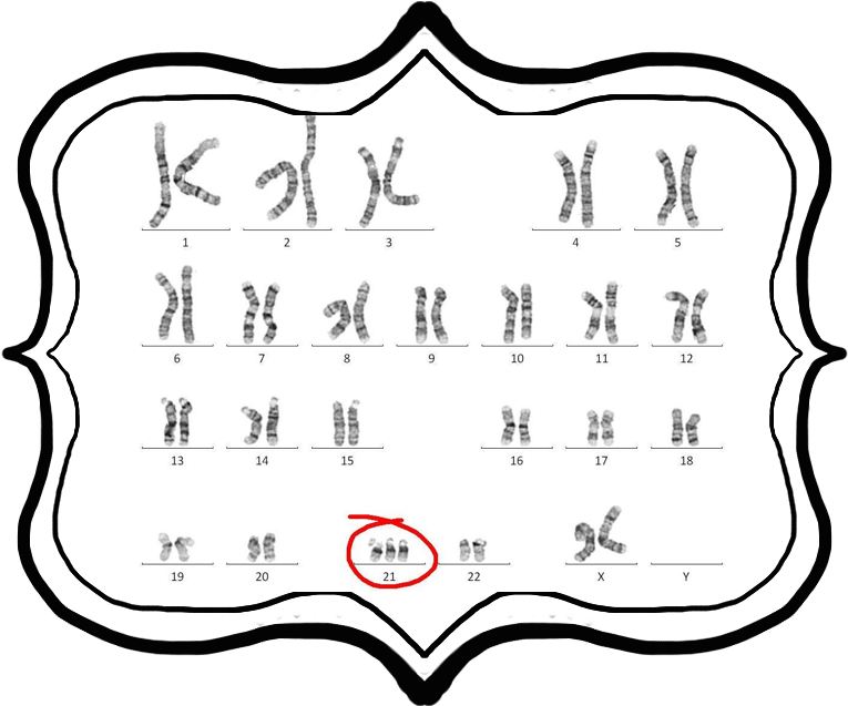 Download Extra Chromosome Causes Down Syndrome - ClipartKey