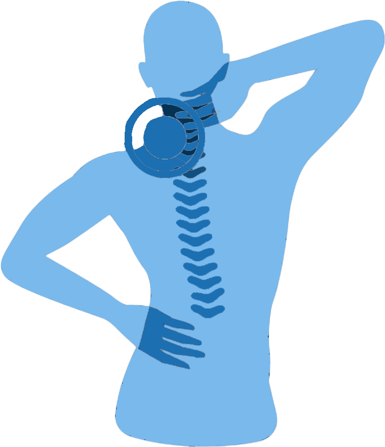 Download Spinal Pain Clipart , Transparent Cartoons - Illustration ...