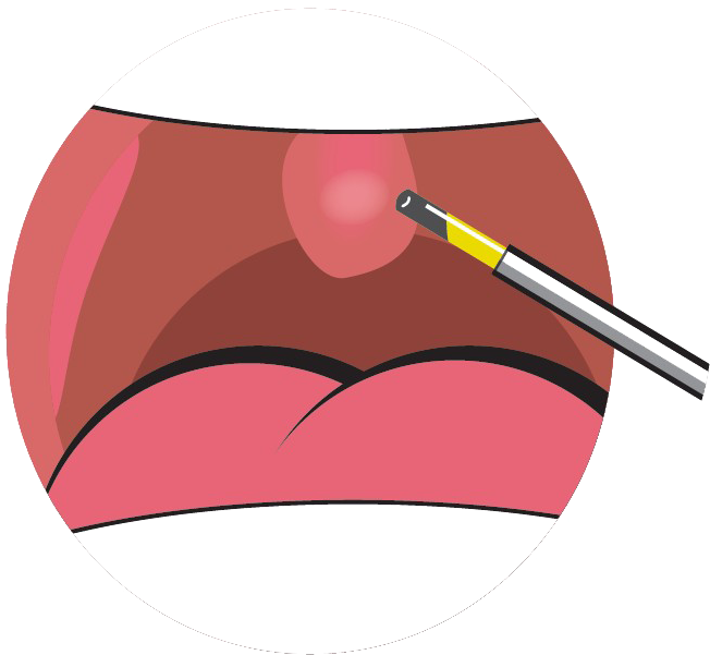 Download Clipart Mouth Tonsils - ClipartKey