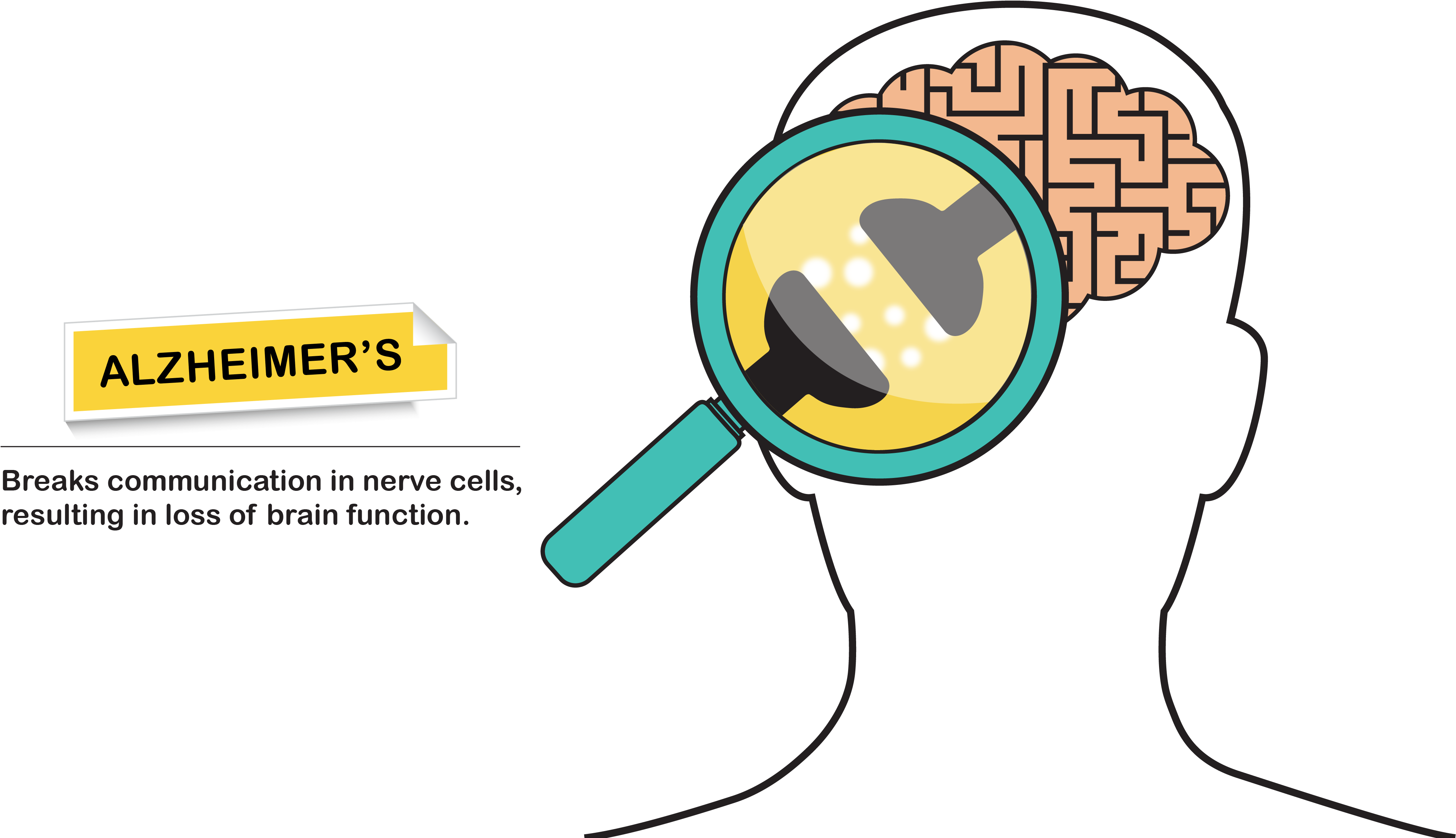 Download Memories Clipart Alzheimer"s Disease Patient - Alzheimer's ...