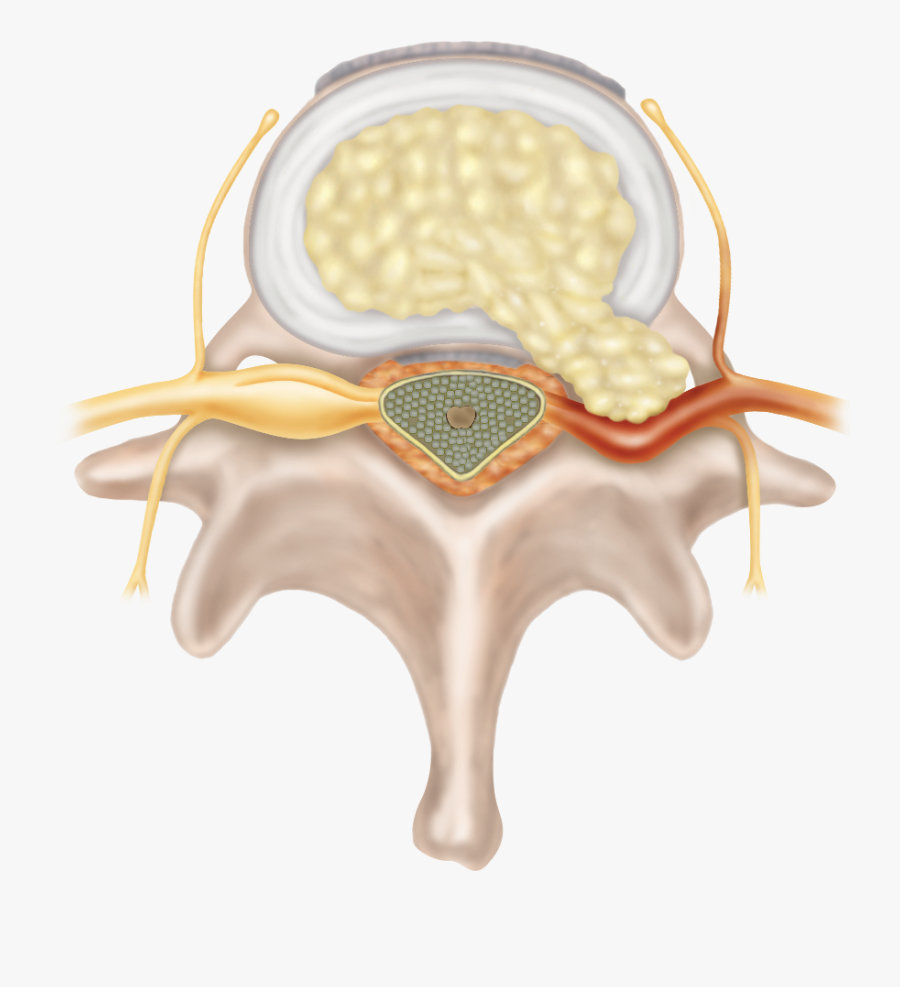 Cerv - Web-hern - Disc - Axial - Intervertebral Disc , Free Transparent ...