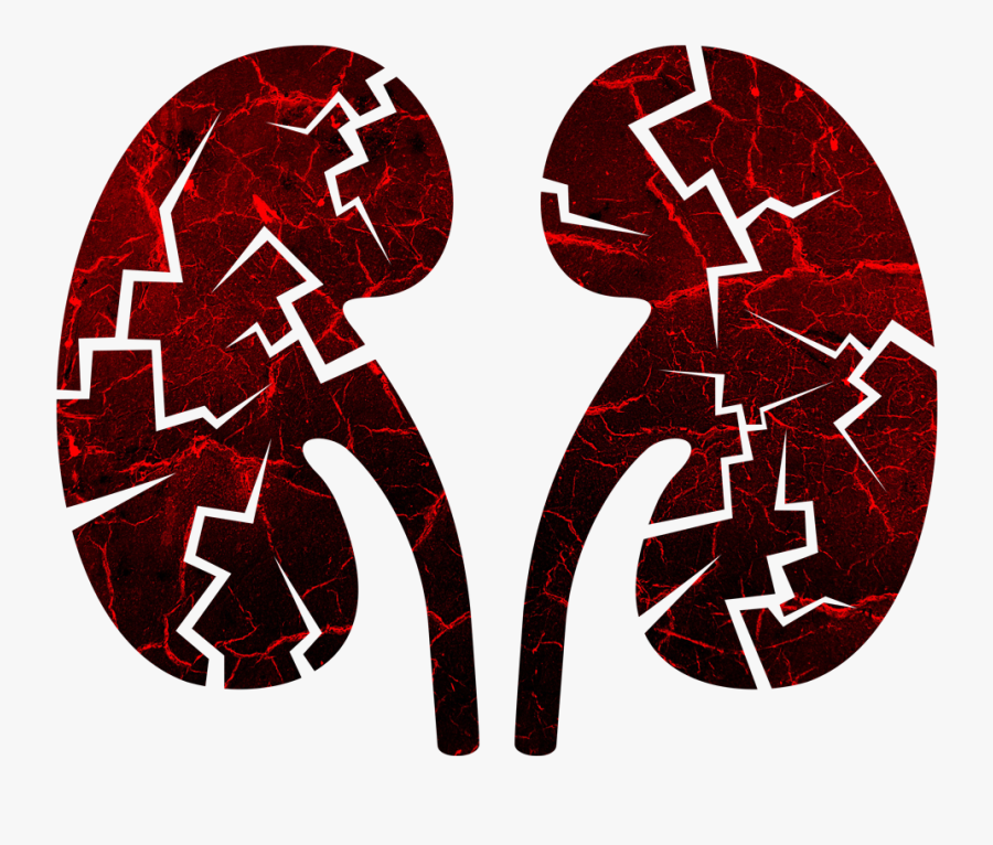 Kidney Damage , Free Transparent Clipart - ClipartKey