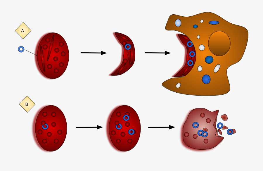 Sickle Cell Anemia Malaria , Free Transparent Clipart - ClipartKey