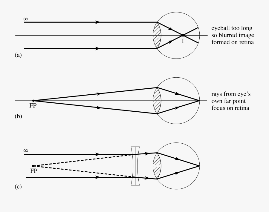 Sighting Drawing Straight Line - Short Sighted Ray Diagram , Free ...