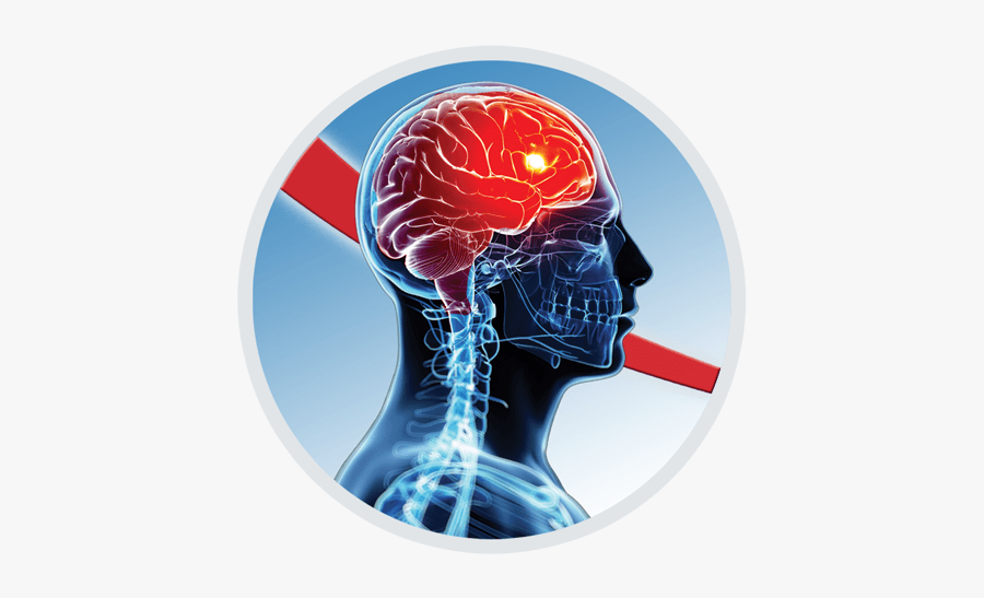 Heat Oppressed Brain , Free Transparent Clipart - ClipartKey