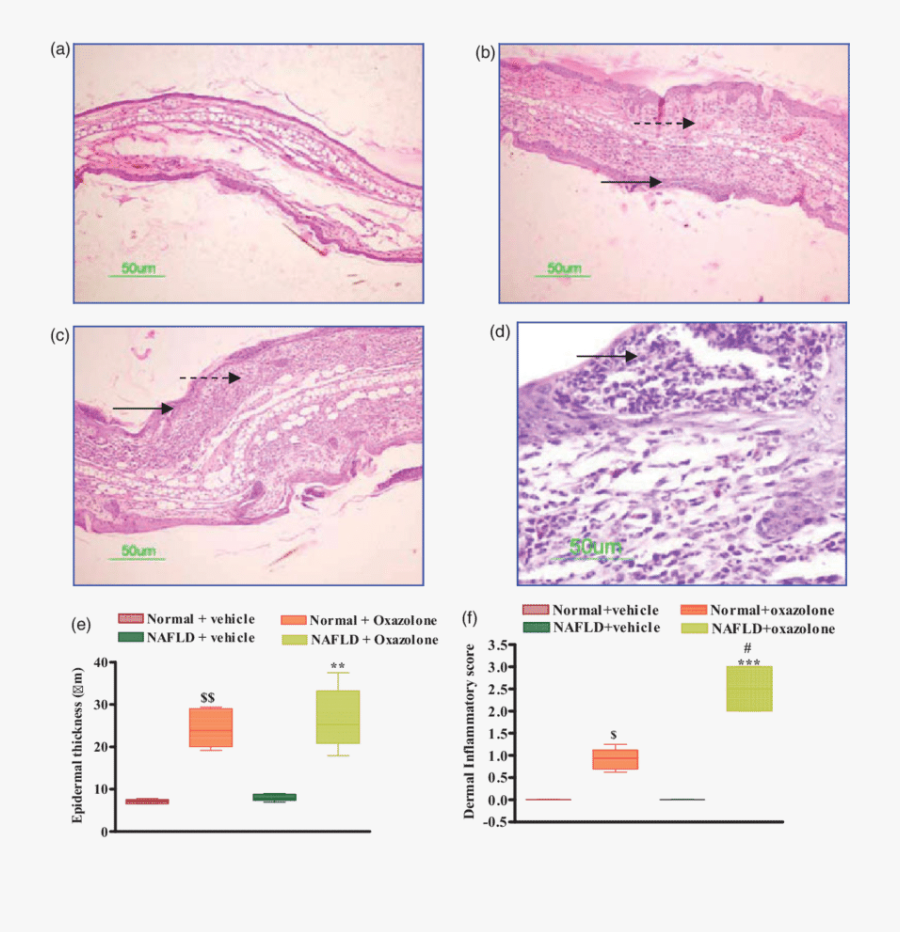 Transparent Mouse Ears Png - Histology Of Normal Mice Ear , Free ...