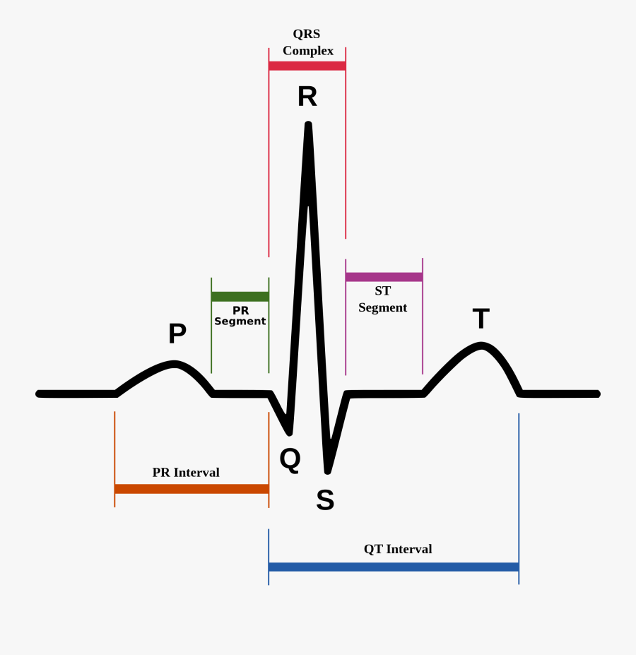 Clip Art Cme Ecg Interpretation Charlie - Normal Sinus Rhythm , Free ...