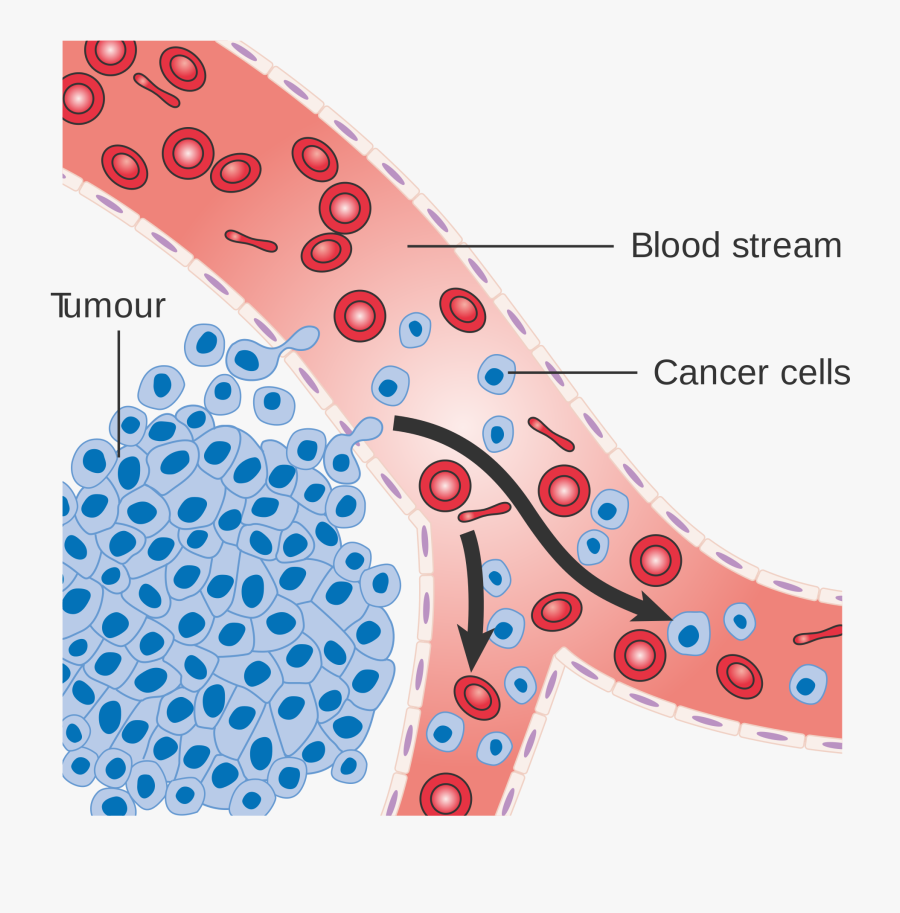 Cancer - Does Cancer Affect Cells , Free Transparent Clipart - ClipartKey