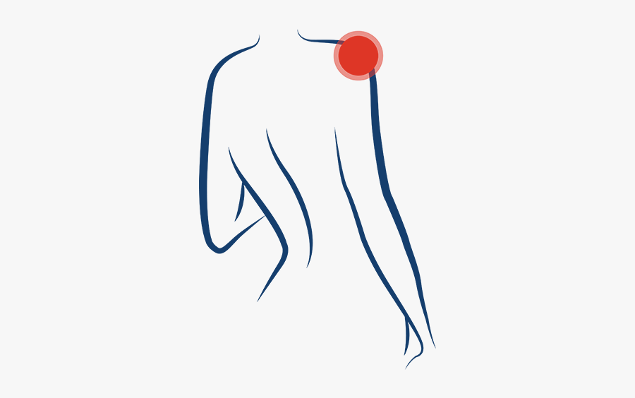 Rotator Cuff Injury , Free Transparent Clipart - ClipartKey