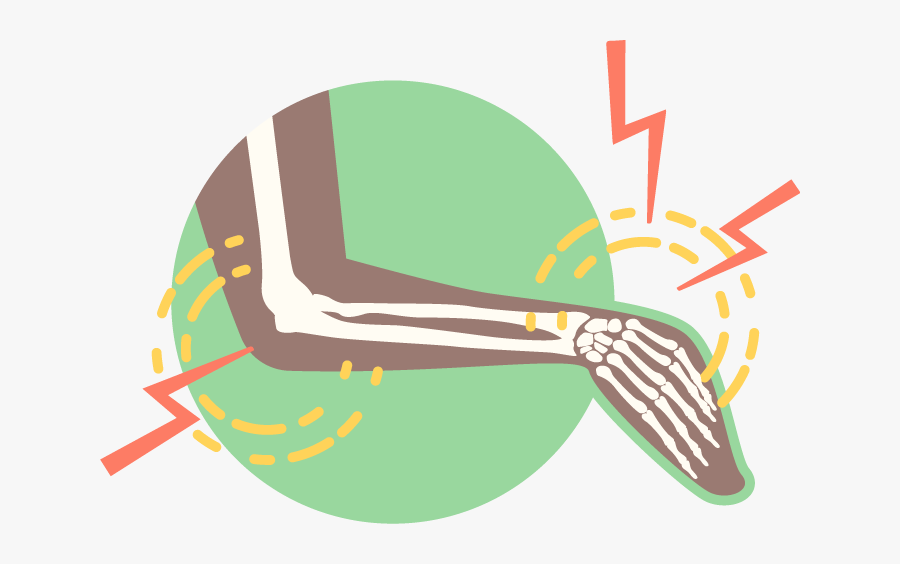 Elbow Clip Art , Free Transparent Clipart - ClipartKey