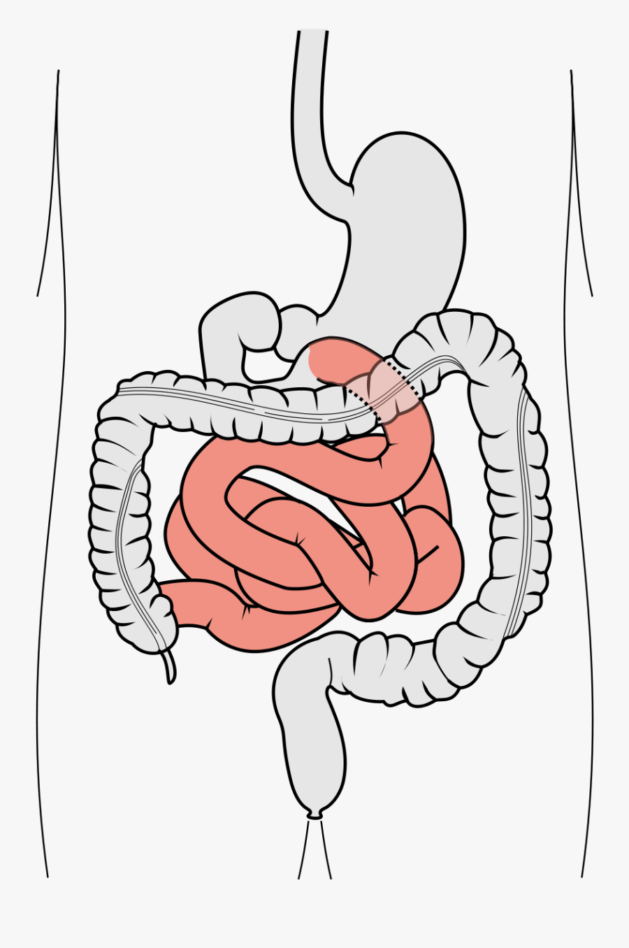 Jejunum And Ileum - Intestinum Png , Free Transparent Clipart - ClipartKey