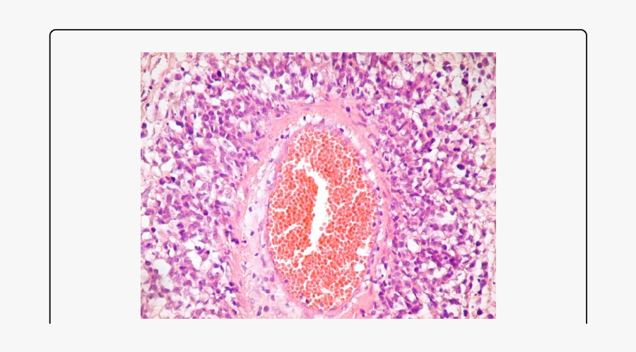 Clip Art Glitter Cells - Circle , Free Transparent Clipart - ClipartKey