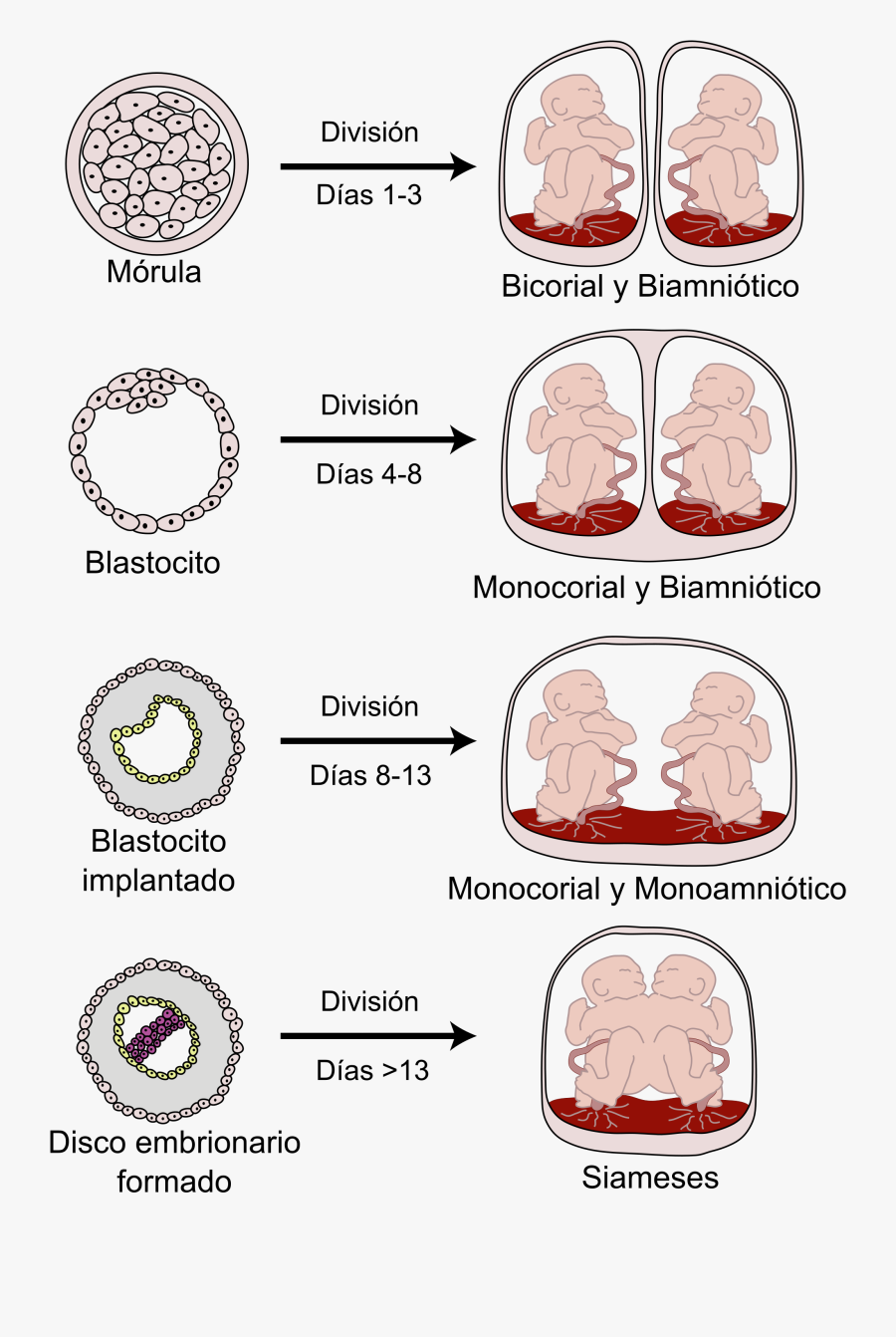 Monochorionic Diamniotic Twins Free Transparent Clipart ClipartKey monochorionic-diamniotic-twins-free-transparent-clipart-clipartkey