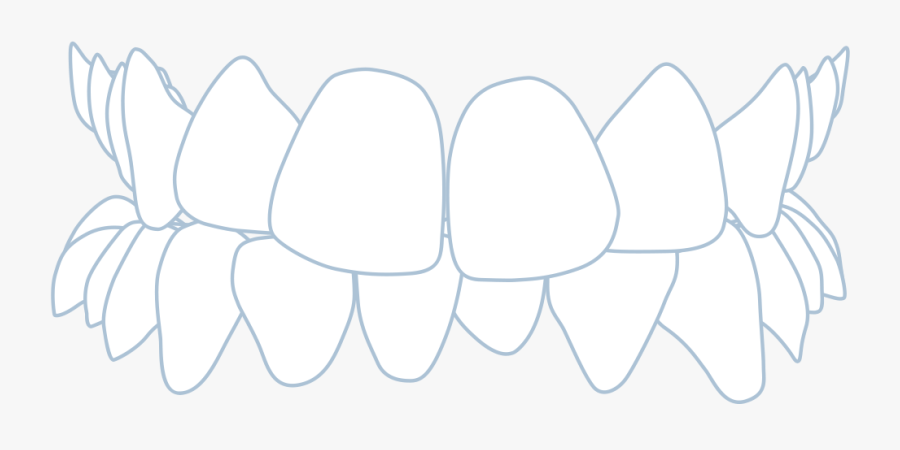 Bite - Drawing , Free Transparent Clipart - ClipartKey