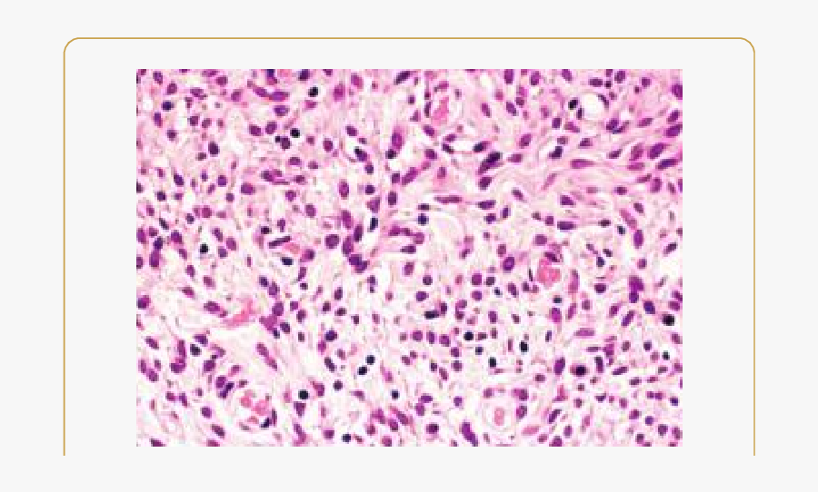 Clip Art The Stroma Contains Spindle - Visual Arts , Free Transparent ...