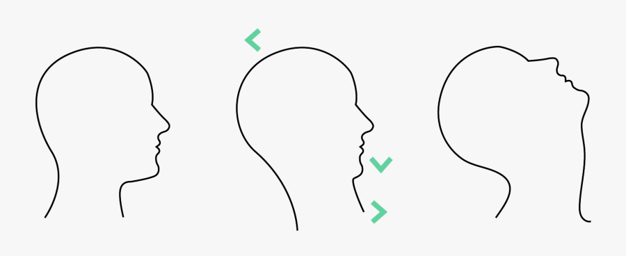 Whiplash - Concussion Transparent , Free Transparent Clipart - ClipartKey