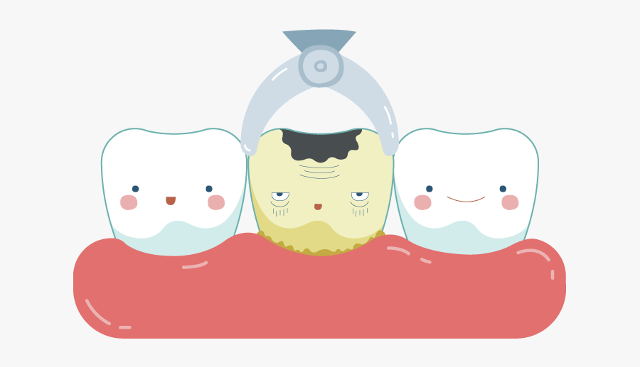 Dental Extractions In Sudbury - Tooth With Filling Cartoon , Free ...