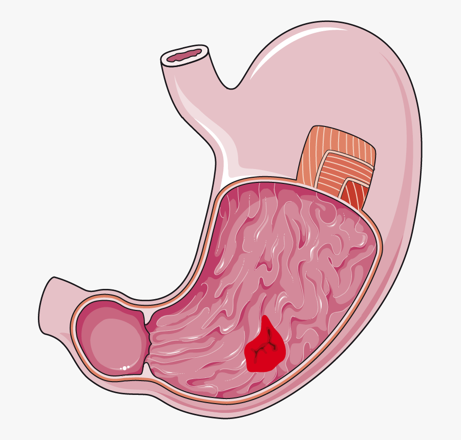 Stomach Clipart Png , Free Transparent Clipart - ClipartKey