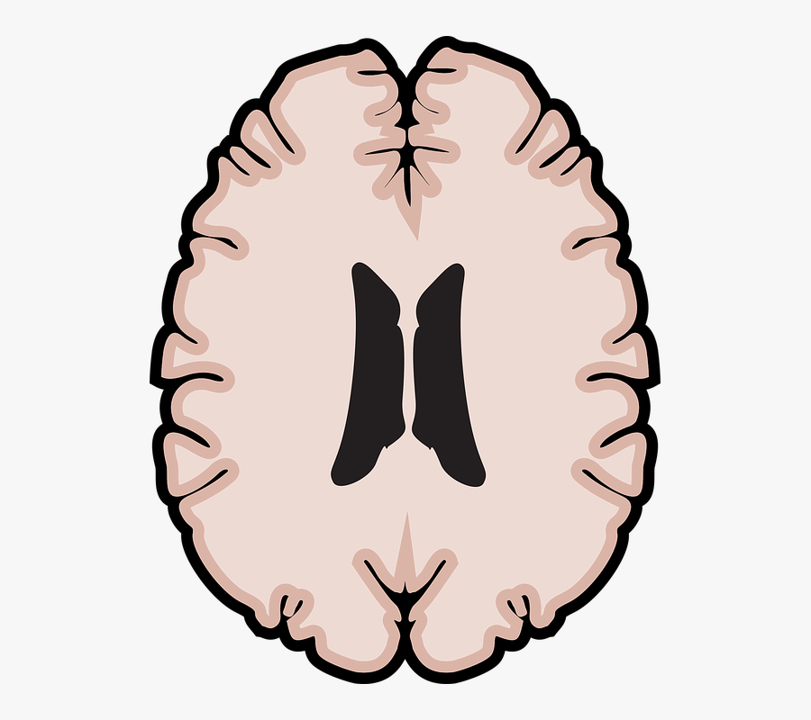 Brain Clipart , Png Download - Brain Scan Vector Free , Free ...