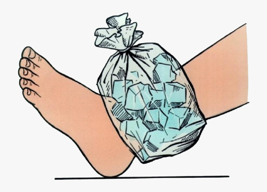 Ice Application To Ankle - Sprained Ankle Clipart , Free Transparent ...
