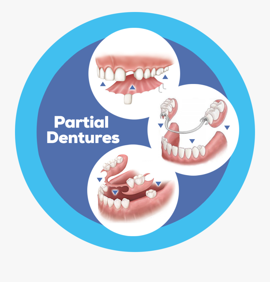 Teeth Wisdom , Free Transparent Clipart - ClipartKey