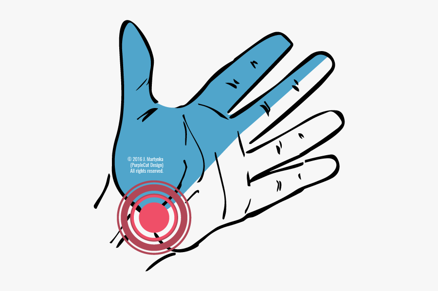 Carpal Tunnel Syndrome - Carpal Tunnel Syndrome Vector , Free ...